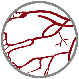 Consulta em Angiologia - Angiodoppler